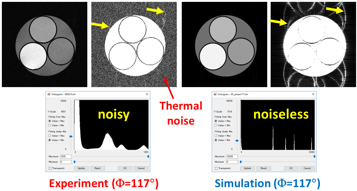 MRI SIMULATOR | MRI simulations