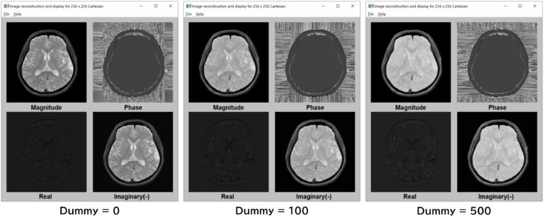 Chapter 8 | MRI simulations