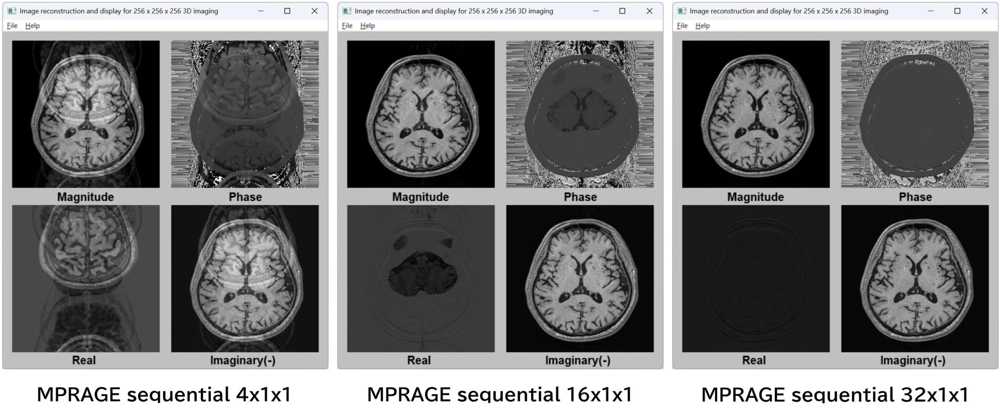 Chapter 10 | MRI simulations