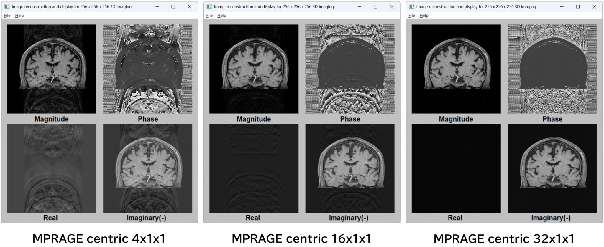 Chapter 10 | MRI simulations