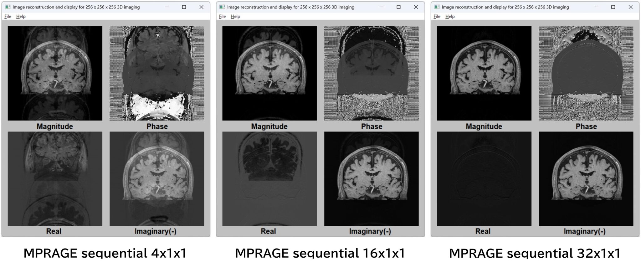 Chapter 10 | MRI simulations