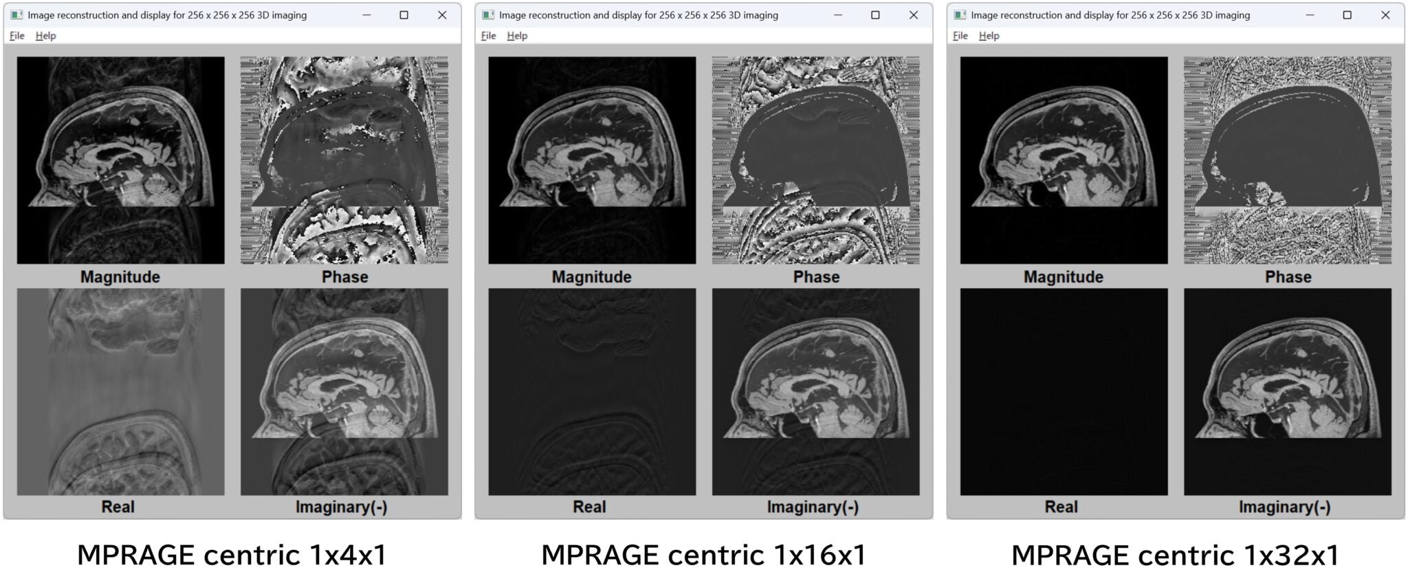 Chapter 10 | MRI simulations