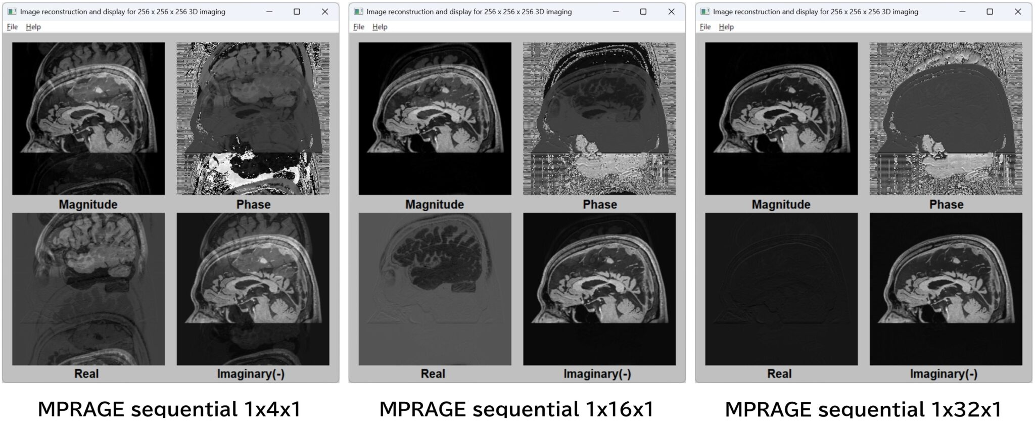 Chapter 10 | MRI simulations